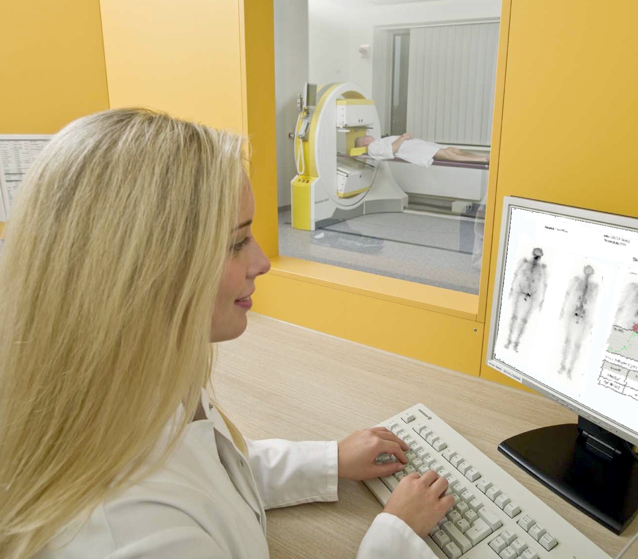 MultiCam 2000 for nuclear medicine - INTER MEDICAL