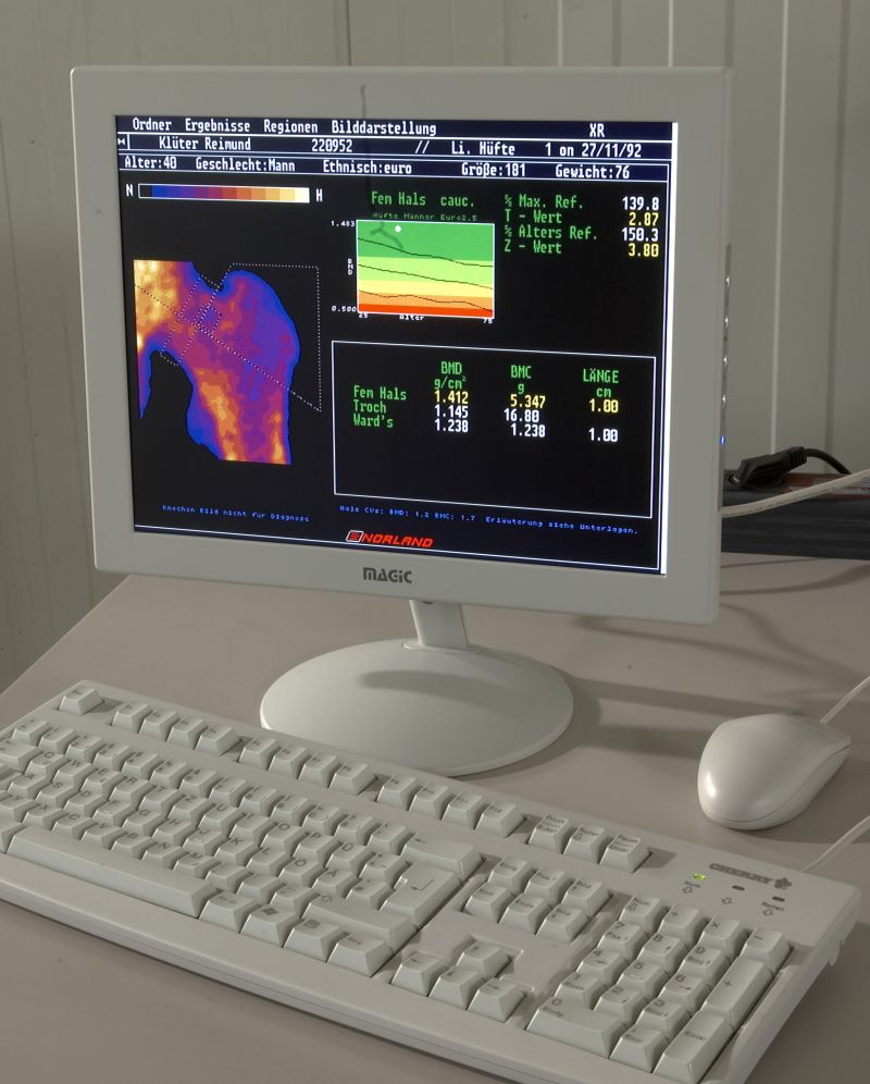 XR 600 - DEXA System - INTER MEDICAL